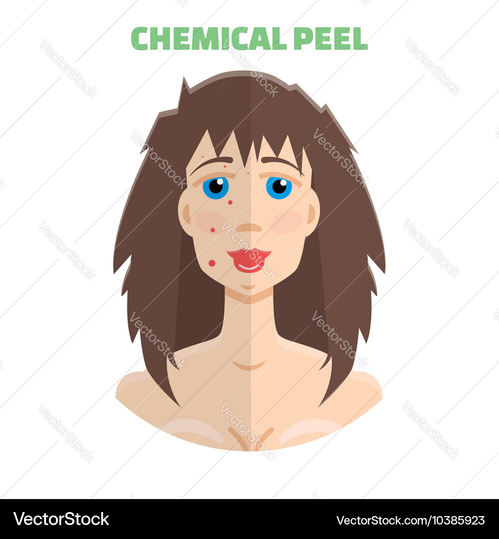 Cosmetic peeling chemical before after Royalty Free Vector