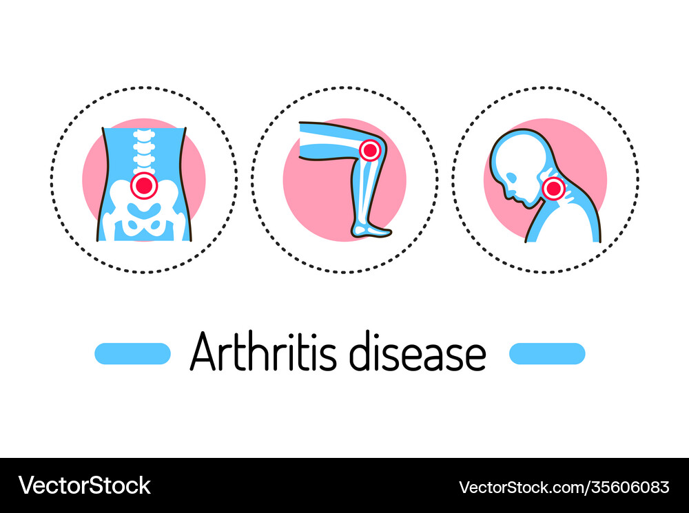 Arthritis disease outline concept inflammation Vector Image
