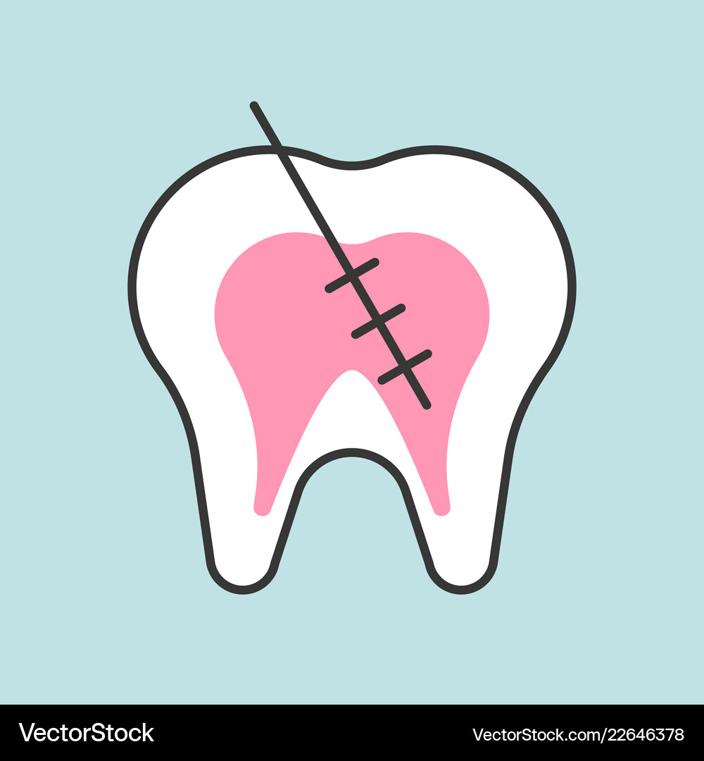 Tooth with root canal treatment or endodontic Vector Image