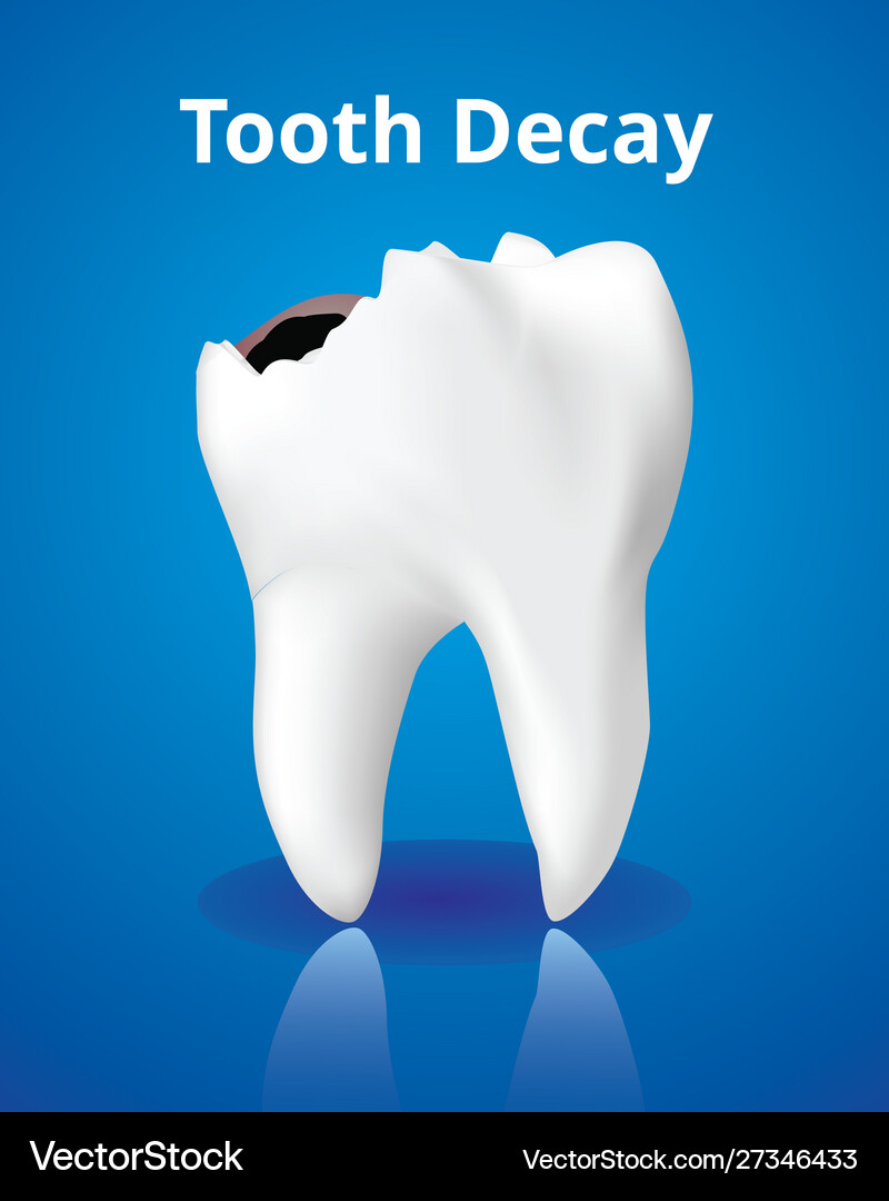 Tooth decay dental care concept realistic design Vector Image