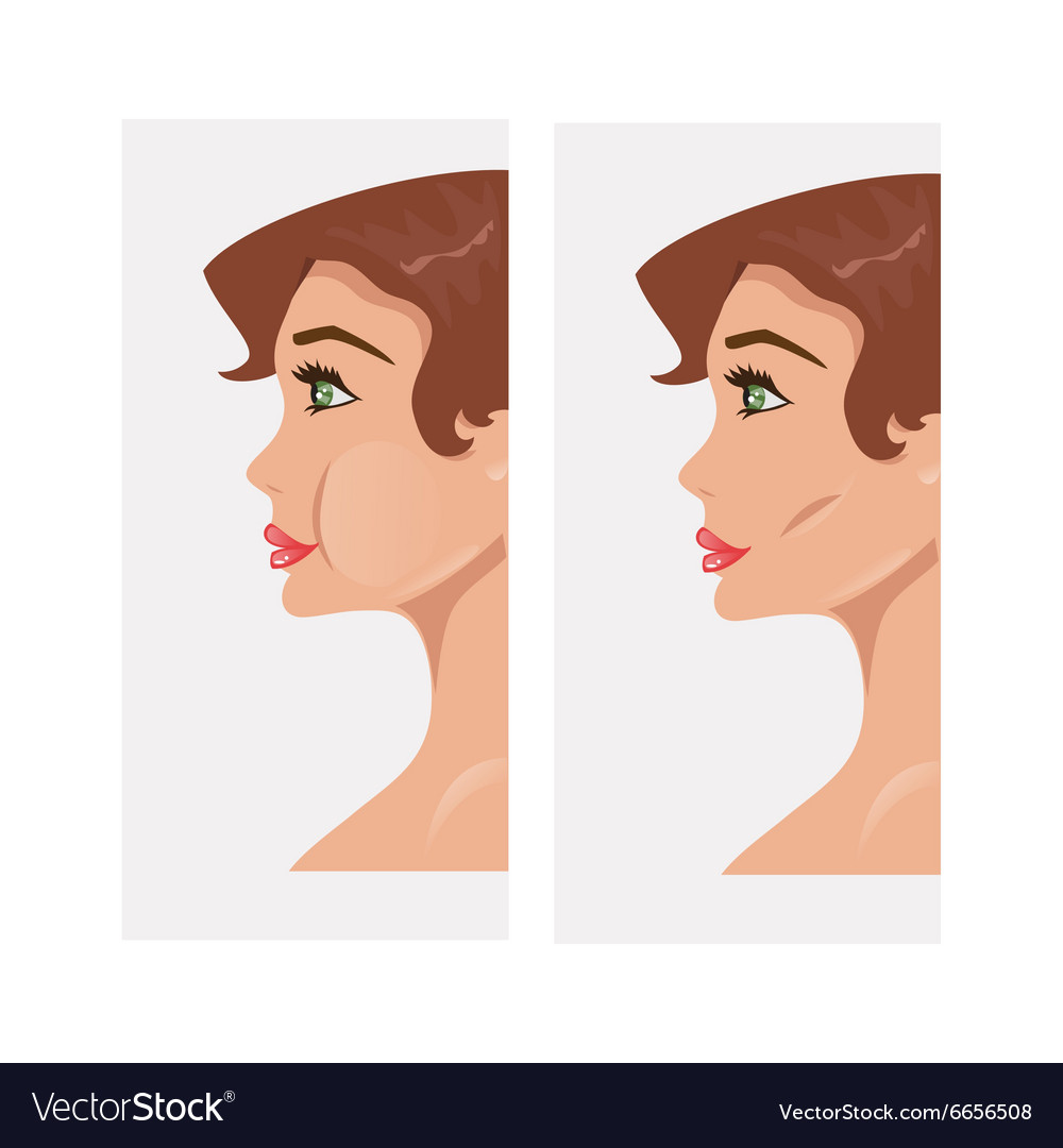 Plastic cheekbones Royalty Free Vector Image - VectorStock