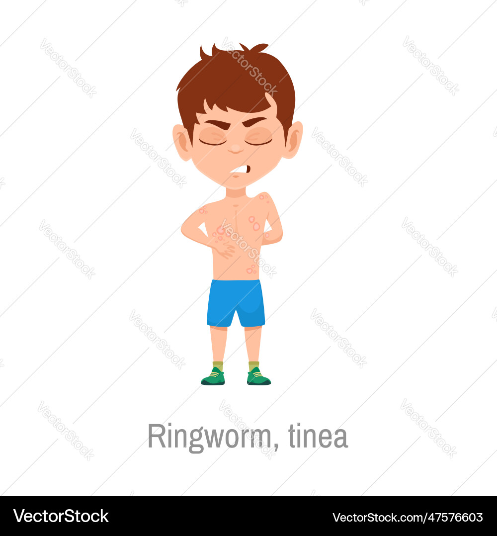 Child with ringworm tinea disease sickness symptom