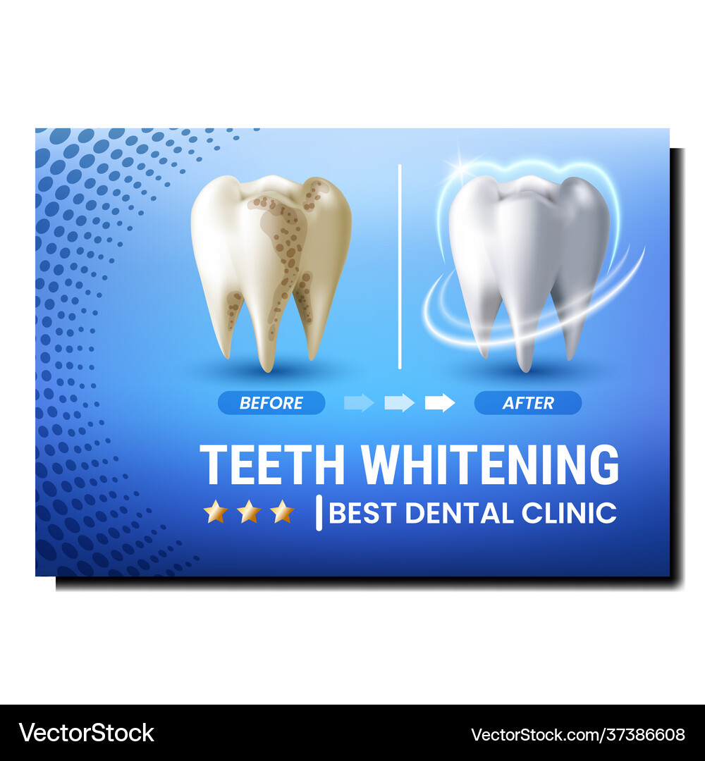 Teeth whitening creative promotional poster Vector Image