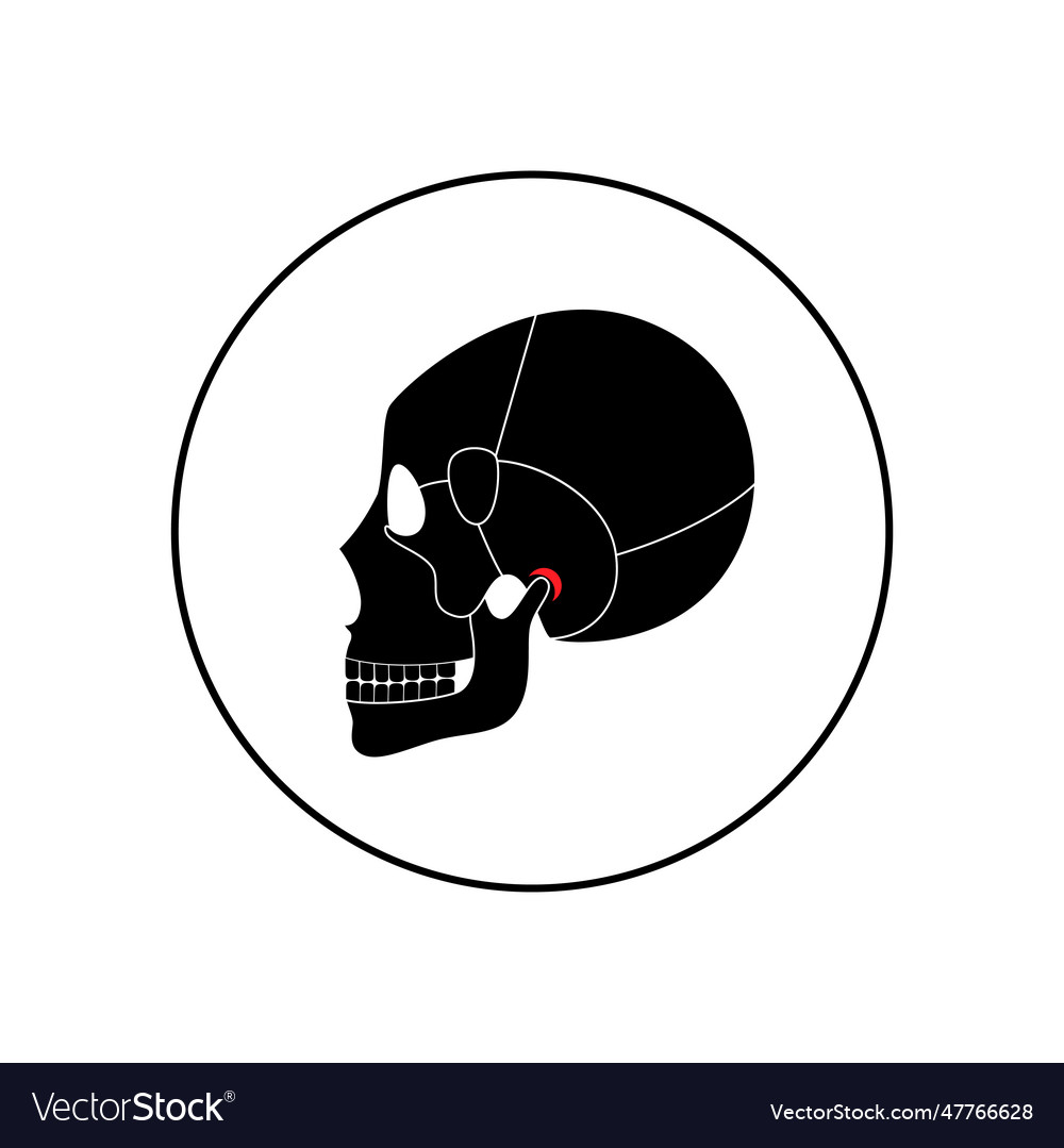 Tmd Tmj Disorder Royalty Free Vector Image Vectorstock