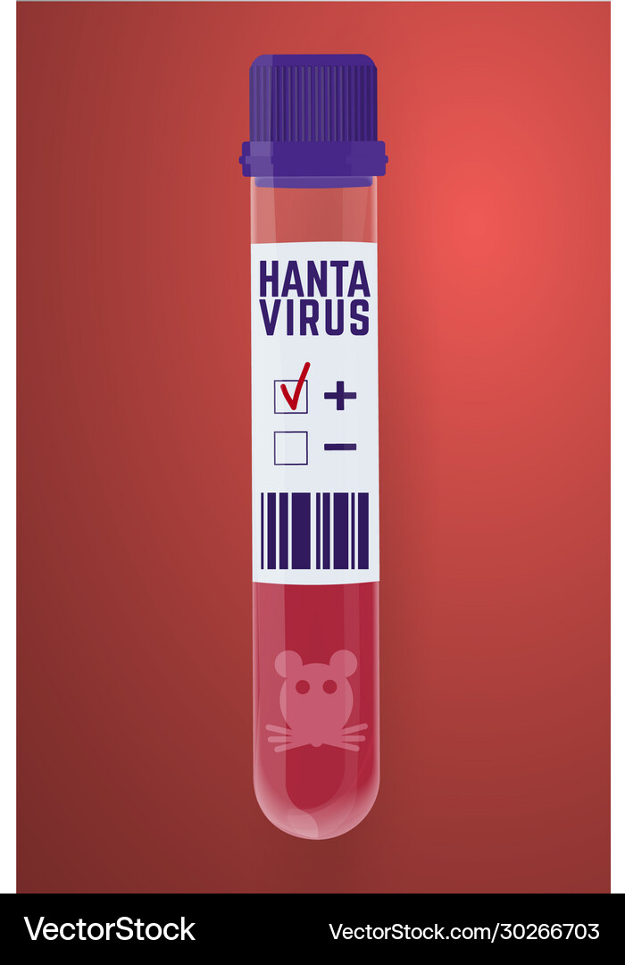 Hantavirus express test vacuum tube Royalty Free Vector