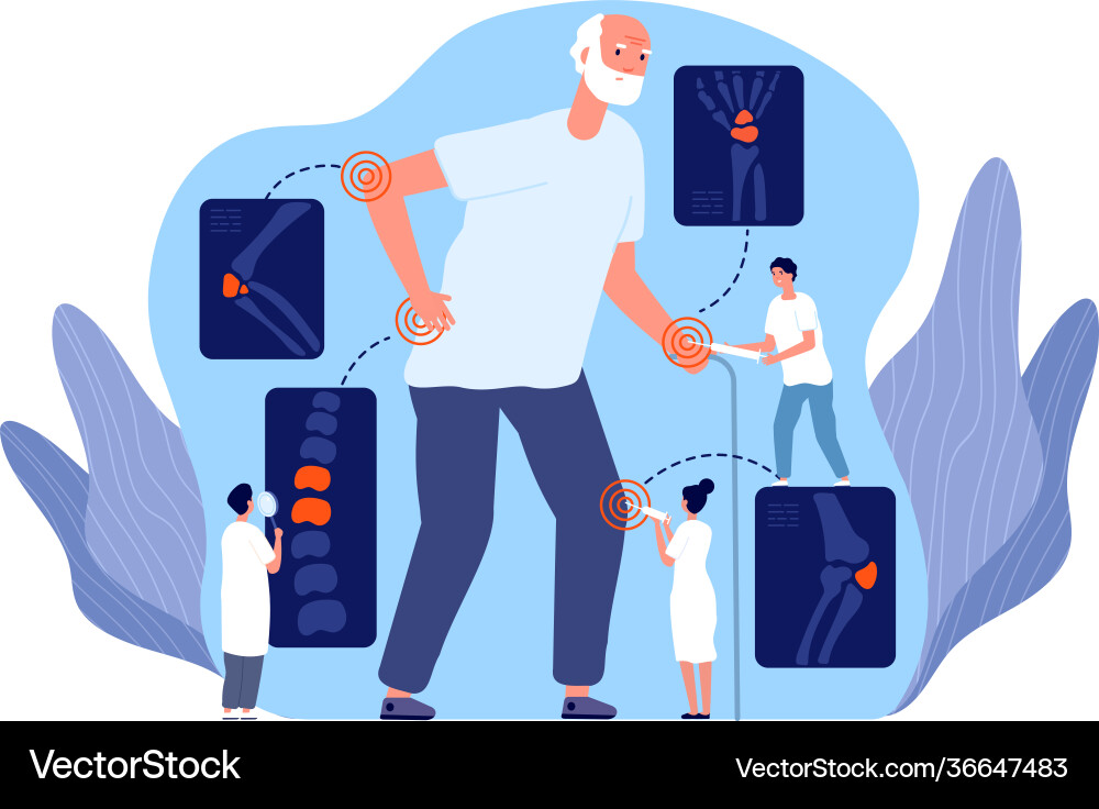 Arthritis rheumatoid joint patellar pain relief Vector Image