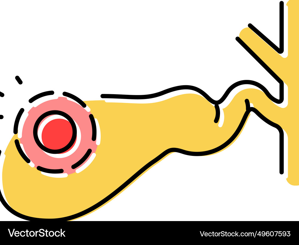 Gallbladder check gastroenterologist color icon Vector Image