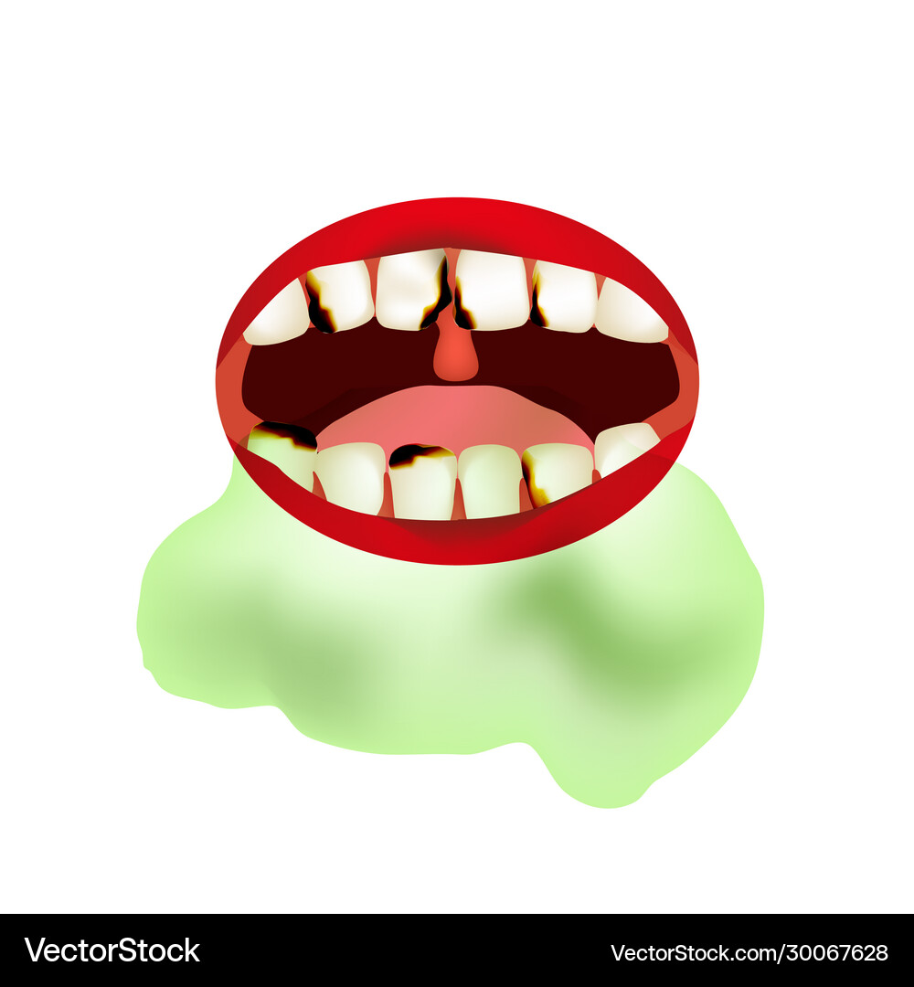 Caries smell from mouth halitosis Royalty Free Vector Image