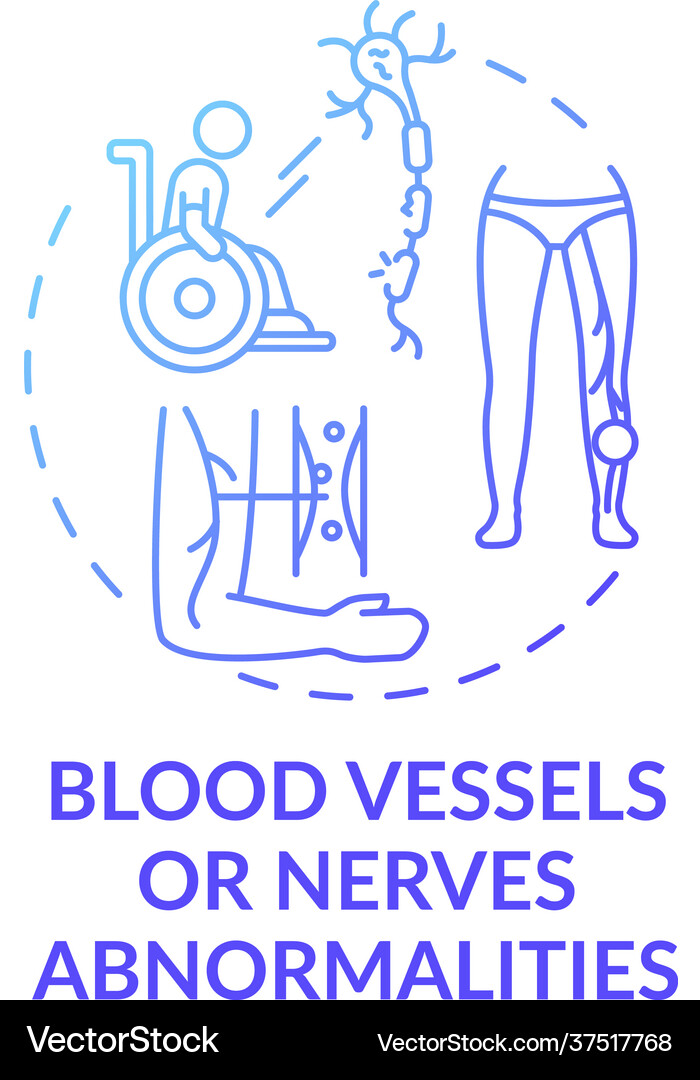 Blood vessels and nerves abnormalities concept Vector Image