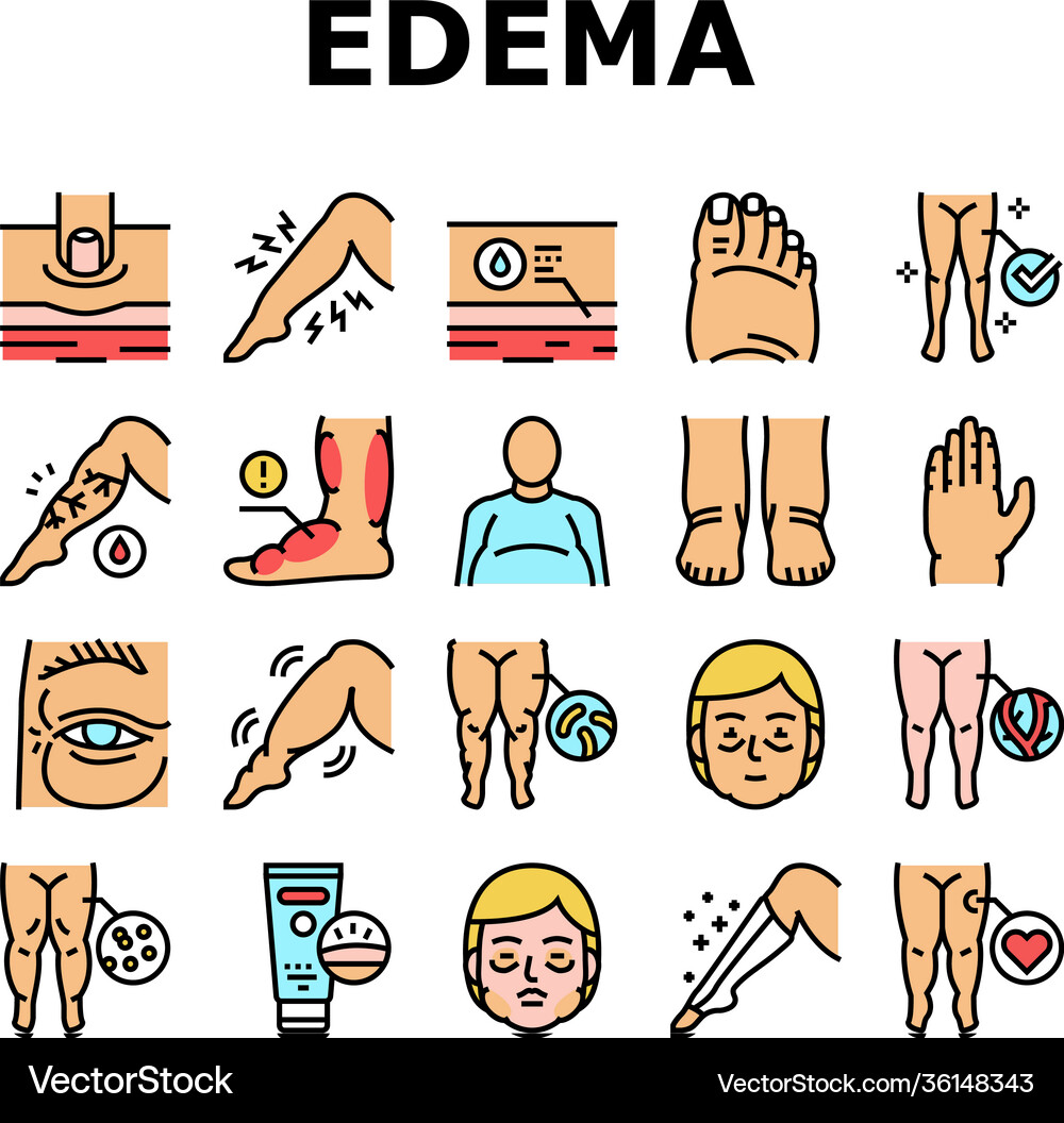 Edema disease symptom collection icons set Vector Image