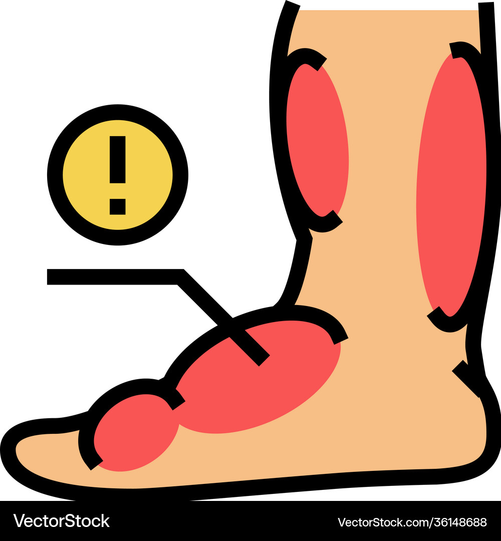 Leg edema critical health problem color icon Vector Image
