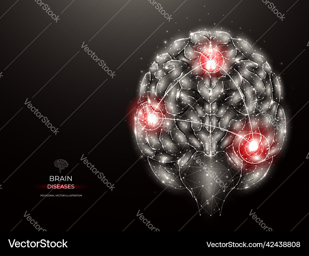 Polygonal of human brain inflammatory disease Vector Image