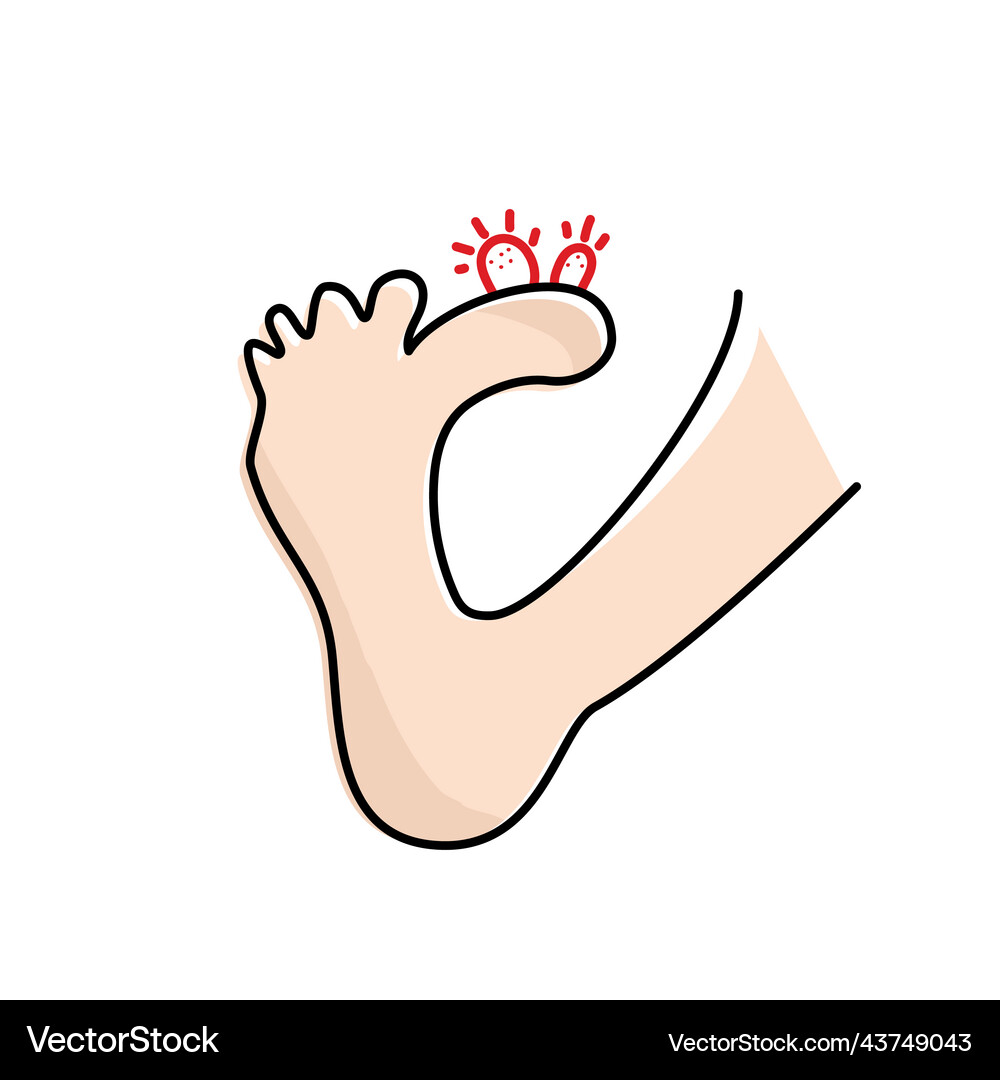 Plantar wart icon verruca symbol foot corn Vector Image