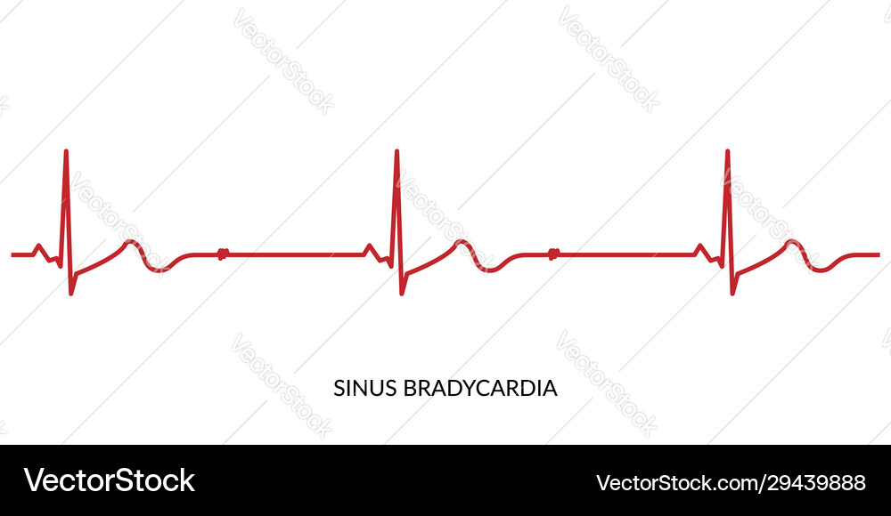 Ecg heartbeat line electrocardiogram sinus Vector Image