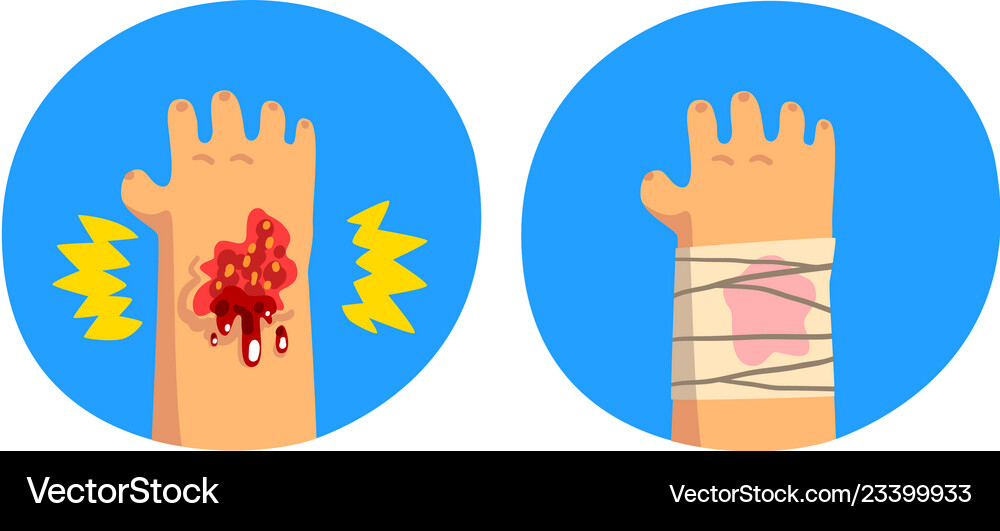 Wounded hand physical injury first aid Royalty Free Vector