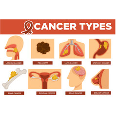 Cancer disease horizontal banners Royalty Free Vector Image