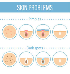 Skin problems icons Royalty Free Vector Image - VectorStock